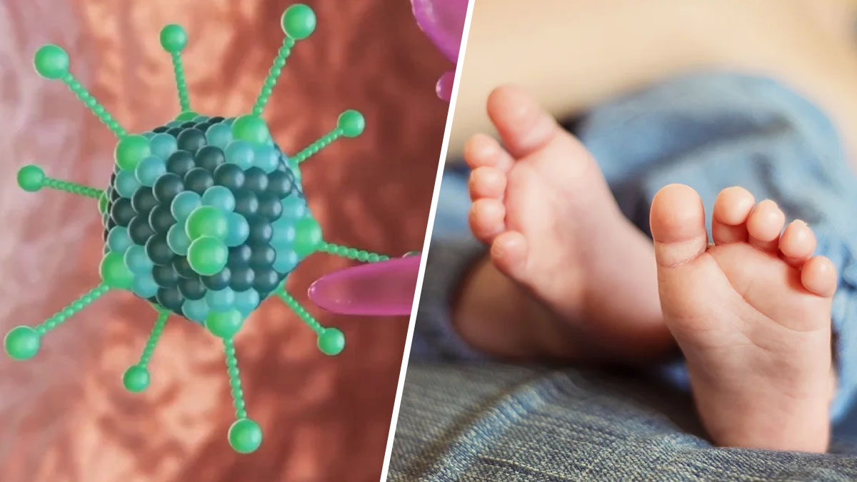 Primer bebé contagiado con monkeypox en Houston – Telemundo Houston