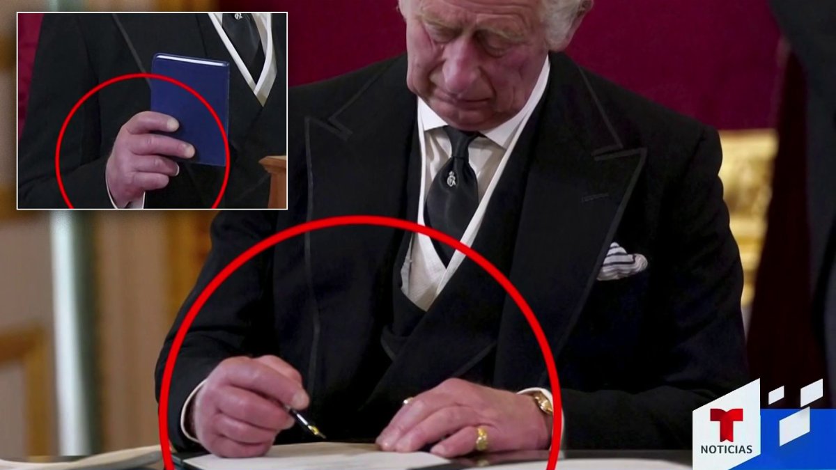 Video: las manos hinchadas y rojas del rey Carlos – Telemundo Houston